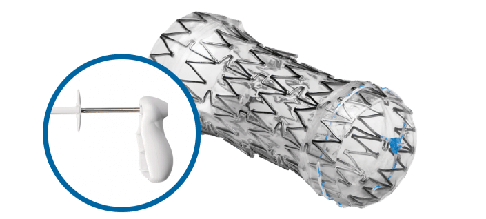 AERO® Fully Covered Tracheobronchial Stent - Merit Medical