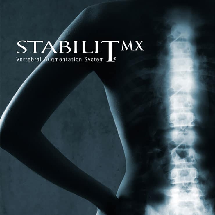 Medical Devices that Improve Lives Throughout the World - Merit Medical