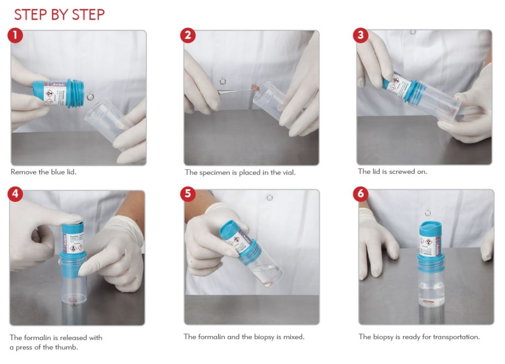 BiopSafe® Система зразків біопсії - Medidea