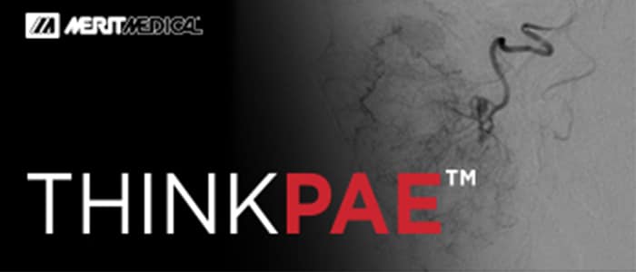 Prostatic Artery Embolization (PAE) - by Merit Medical