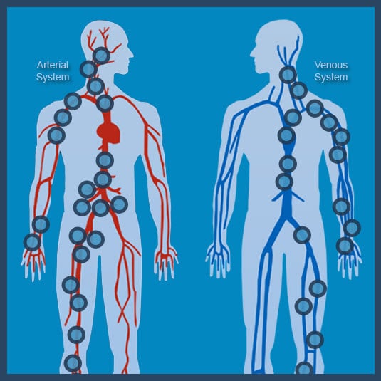 EN Snare® Endovascular Snare System | Merit Medical