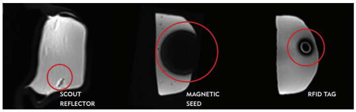 SCOUT® Radar Localization | Tumor Localization | Merit Medical