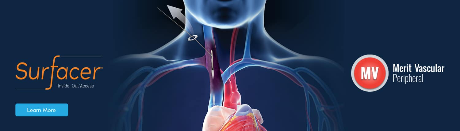 Peripheral Intervention Products - Access, Angiography, Biopsy & More