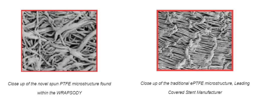 Merit WRAPSODY™ Cell-Impermeable Endoprosthesis - Merit Medical