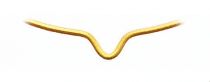 ONE Snare System - LV Lead Delivery Option for Challenging Anatomy