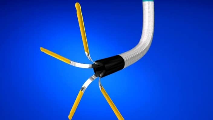 Ostial PRO® Stent Positioning System - More Accurate Stent Positioning