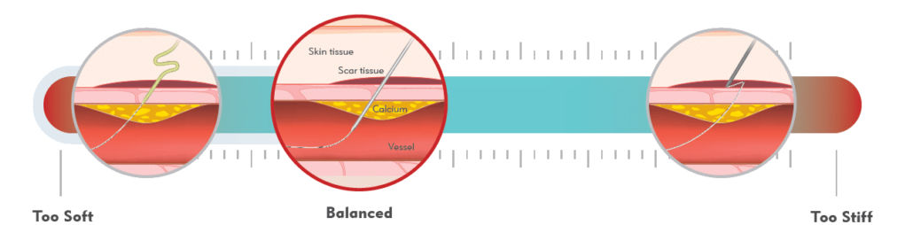 Micro ACE™ Advanced Micro-Access System - Merit Medical