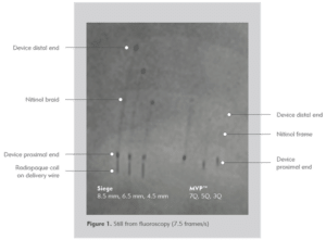Siege™ Vascular Plug - Merit Medical